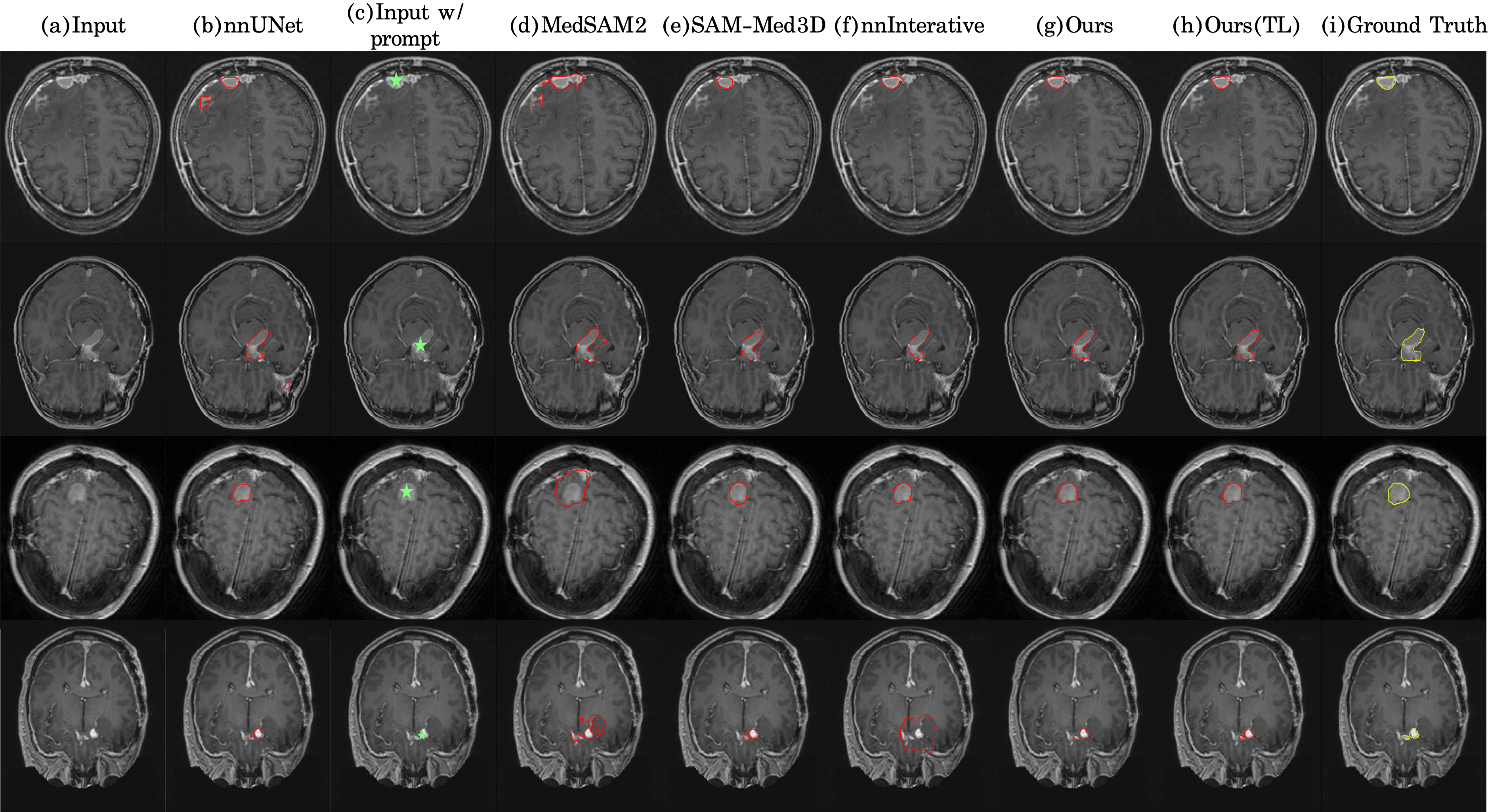 Interactive-MEN-RT